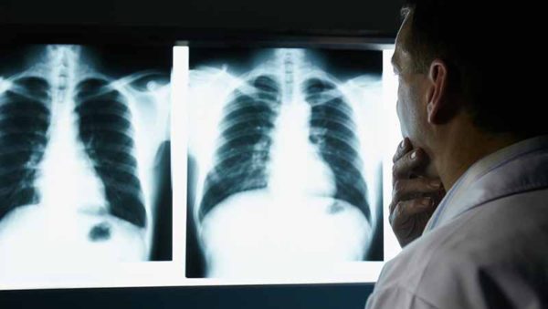 Radiografía del hombre disoluto. Diego Chiaramoni | Posmodernia